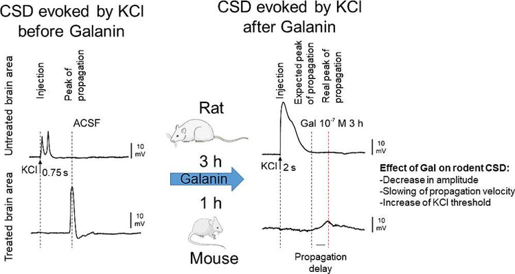 Galanin: A Promising New Treatment for Migraine with Aura – Cerebral Torque