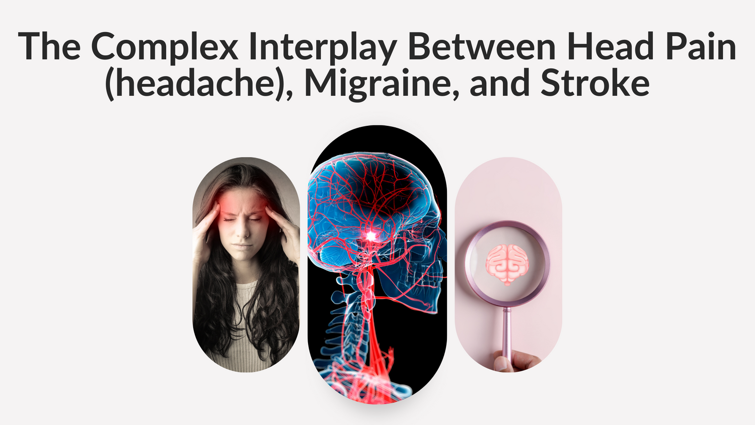 The Complex Interplay Between Head Pain (headache), Migraine, and Stro ...